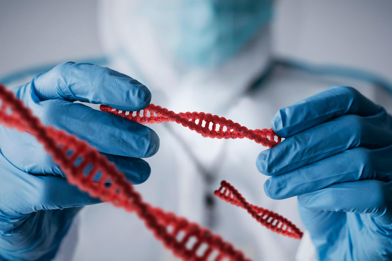 Calcium Oxalate Stones Formation and Prevention