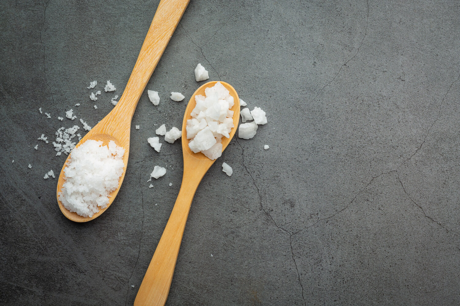 Calcium Oxalate Stones Formation and Prevention