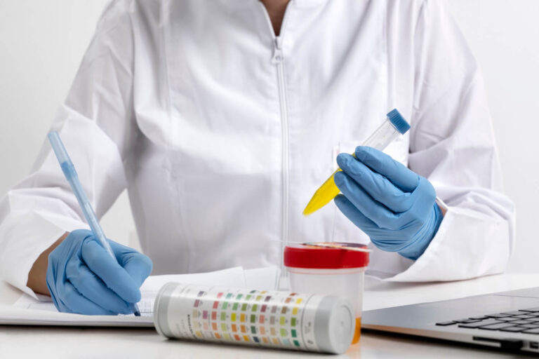 Urine Test for UTI: How It Works and Its Role in Diagnosis