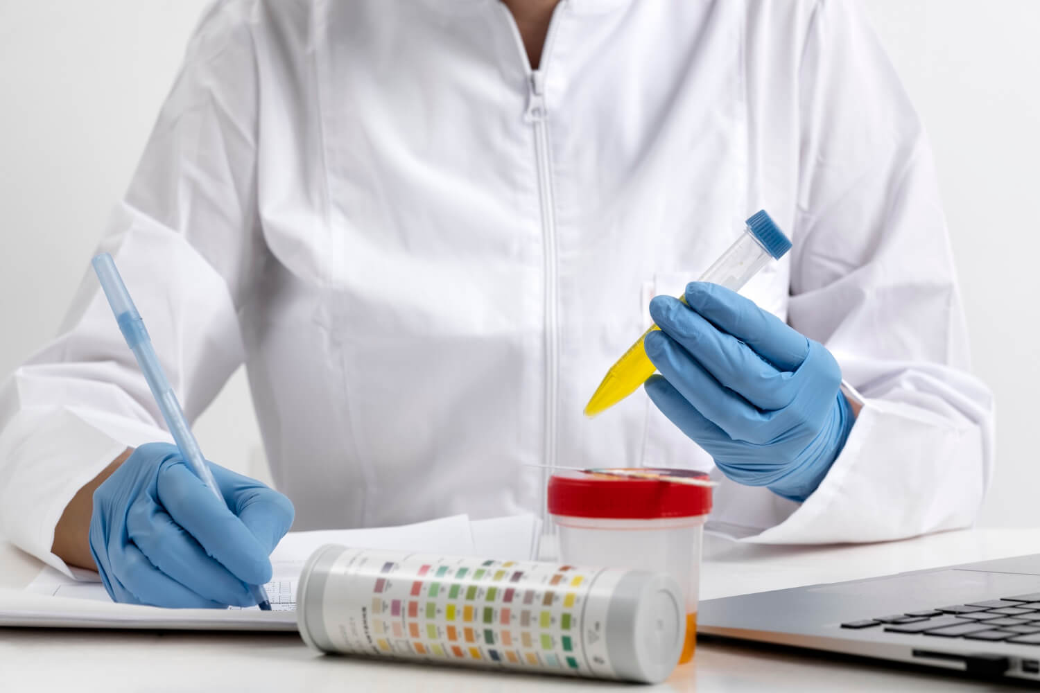 Urine Test for UTI: How It Works and Its Role in Diagnosis