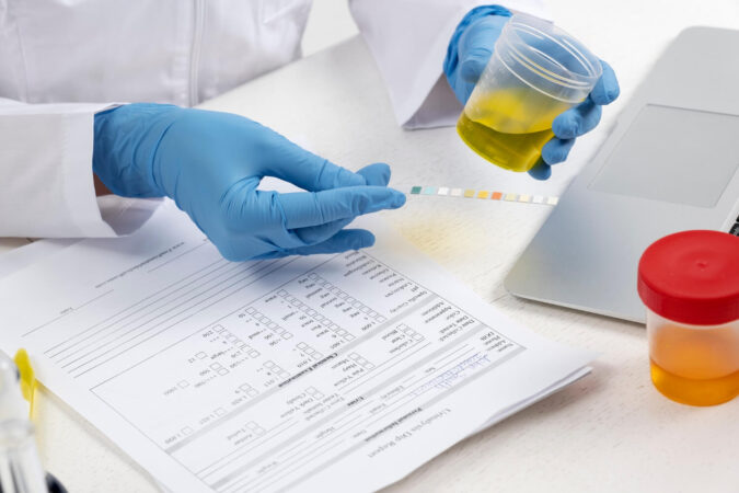 Urine Test for UTI: How It Works and Its Role in Diagnosis