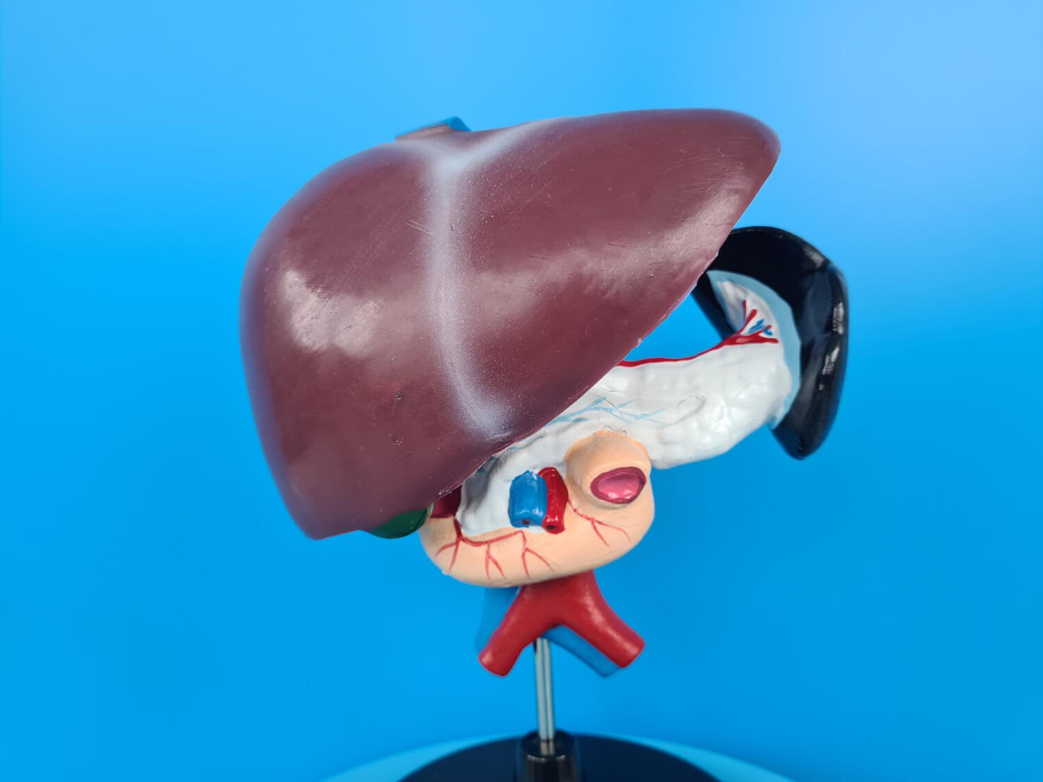 Cirrhosis of the Liver Symptoms: Detecting Signs for Liver Health ...