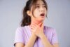 Strep Throat Treatment Strategies for Relief - NowServing Health