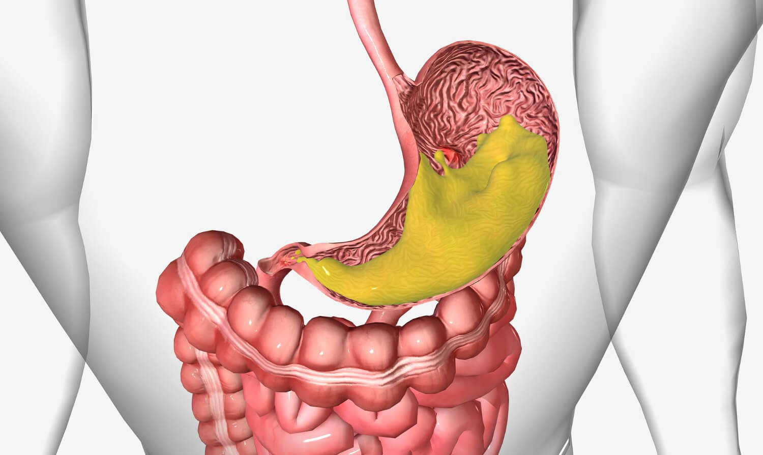 Learn Gastroesophageal Reflux Disease (GERD) Treatment