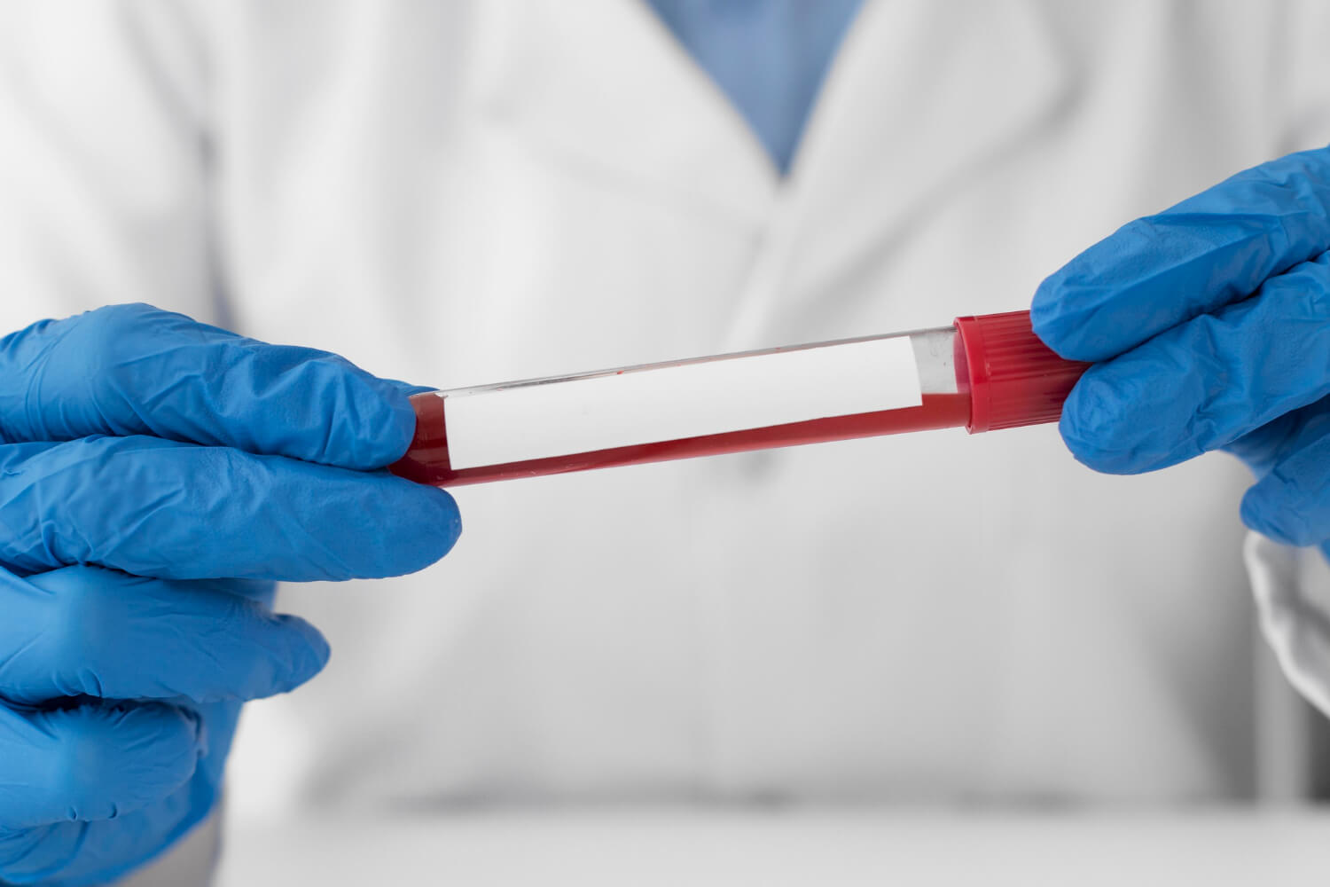 Unveiling the Truth: HIV Test Accuracy Explained