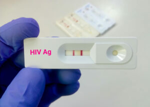 Essential Guide to HIV Test Kit: Types, Usage, Reliability