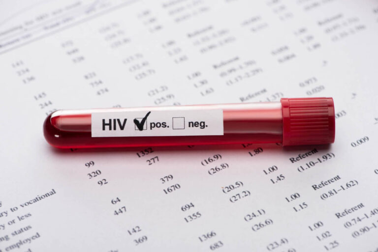 Simplifying HIV Home Testing: A Comprehensive Guide