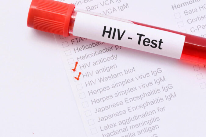 Essential Guide to HIV Test Kit: Types, Usage, Reliability