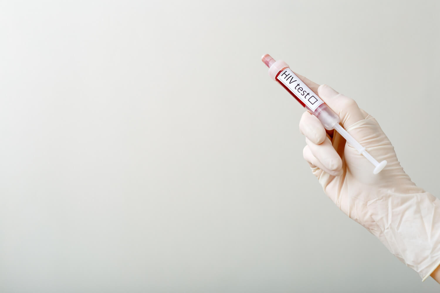 HIV Window Period: Testing with Precision