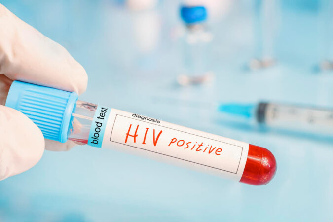 HIV Test Price: Exploring Testing Options Available