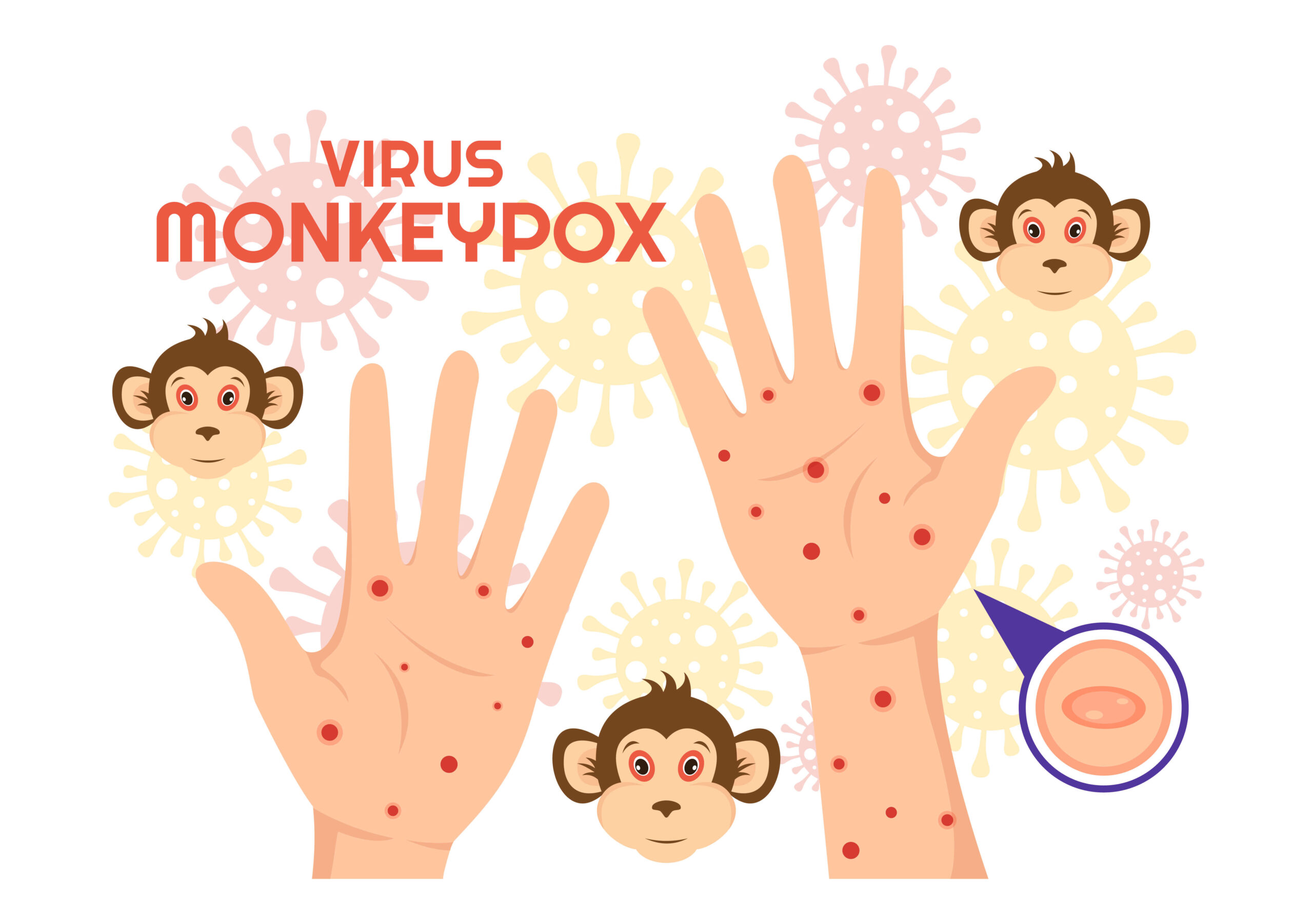 Understanding Mpox Risk Factors: Vulnerability Analysis