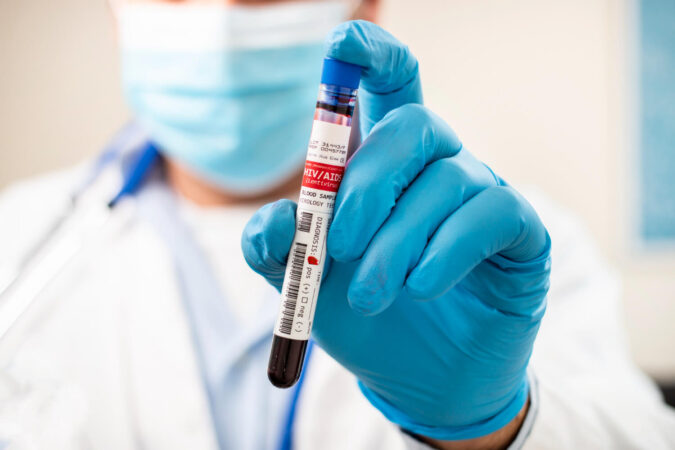 HIV Sample Collection: Methods for Precision