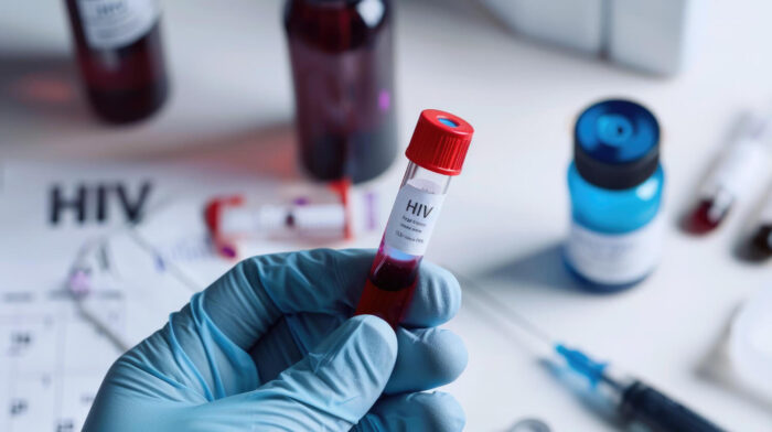 Ultimate Guide to HIV Test Kit Usage Techniques