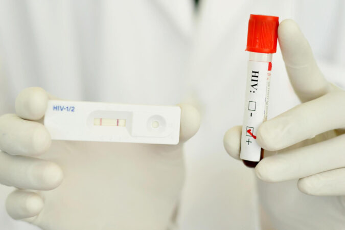 Mastering Reading HIV Test Results: Complete Guide