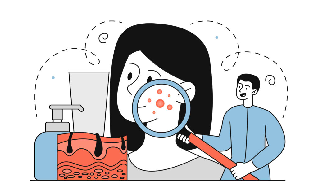 Treating Mpox at Home: Ultimate Remedies Guide