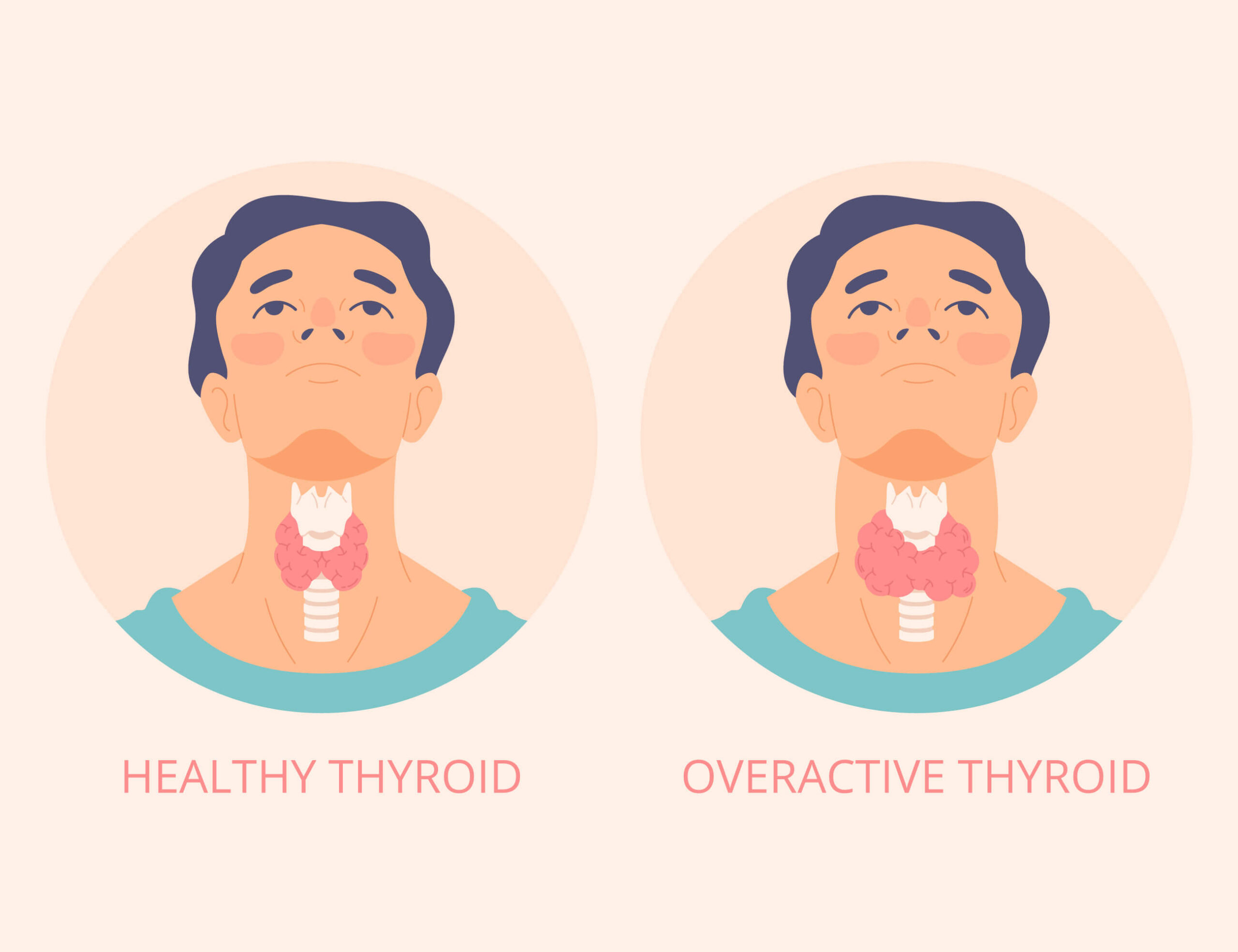 Detect Symptoms of Thyroid Problems and Take Action Now